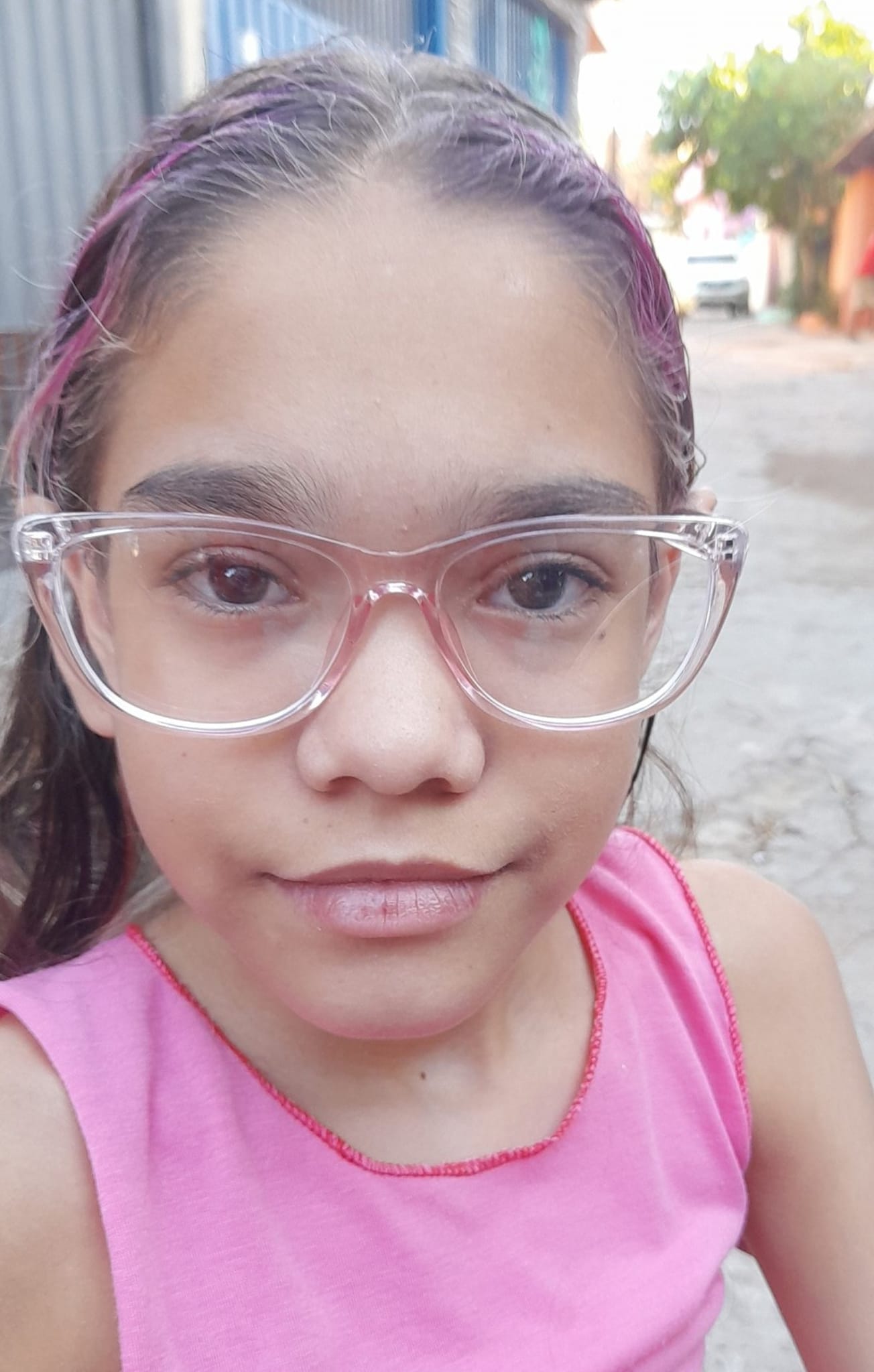 Esperanzador: Bianca recibió el Trixacar para tratar la fibrosis ...